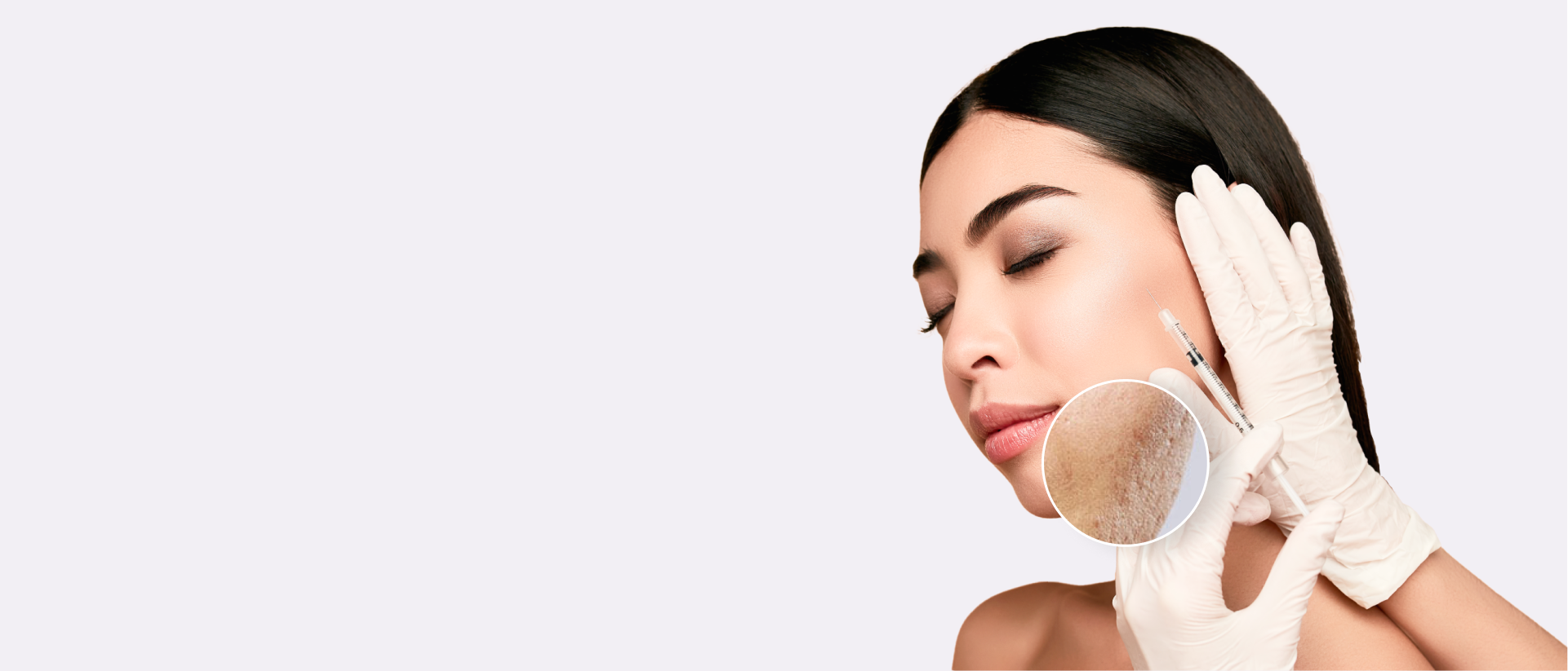 Mesobotox Treatment in Hyderabad | Sasha Clinics