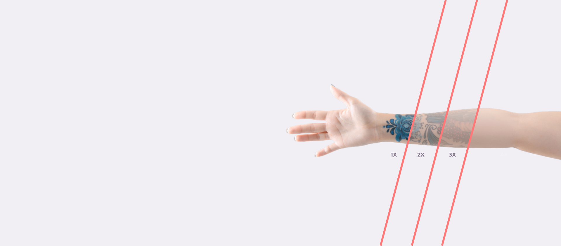 Laser Treatment for Tattoo Removal in Hyderabad | Sasha Clinic