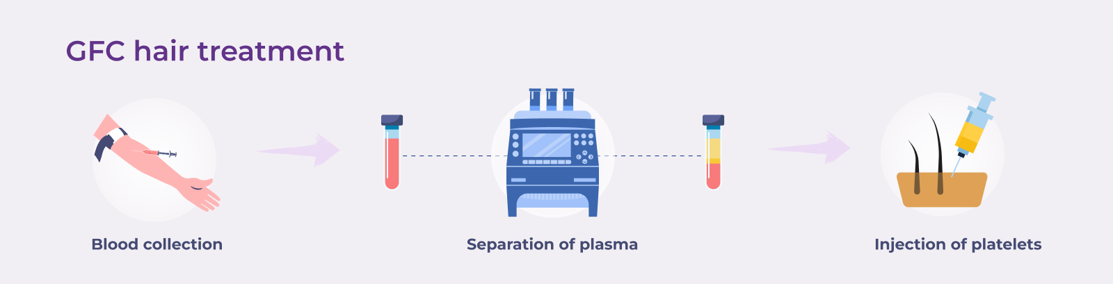 Best GFC Treatment in Hyderabad | Sasha Clinics