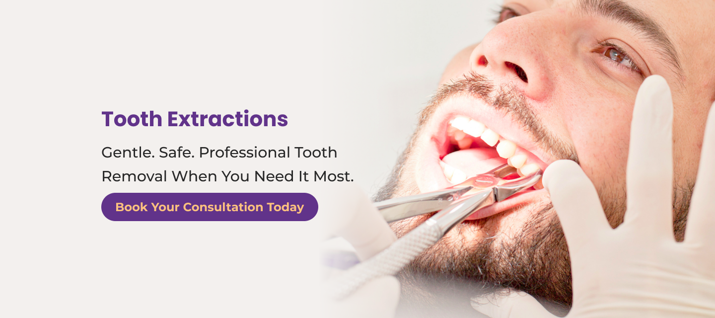 Tooth Extractions - Sasha