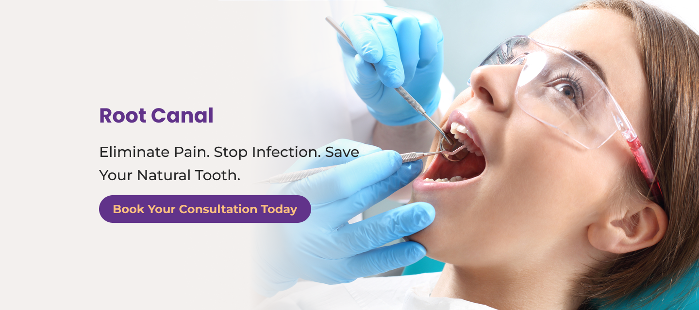 Root Canal Treatment - Sasha