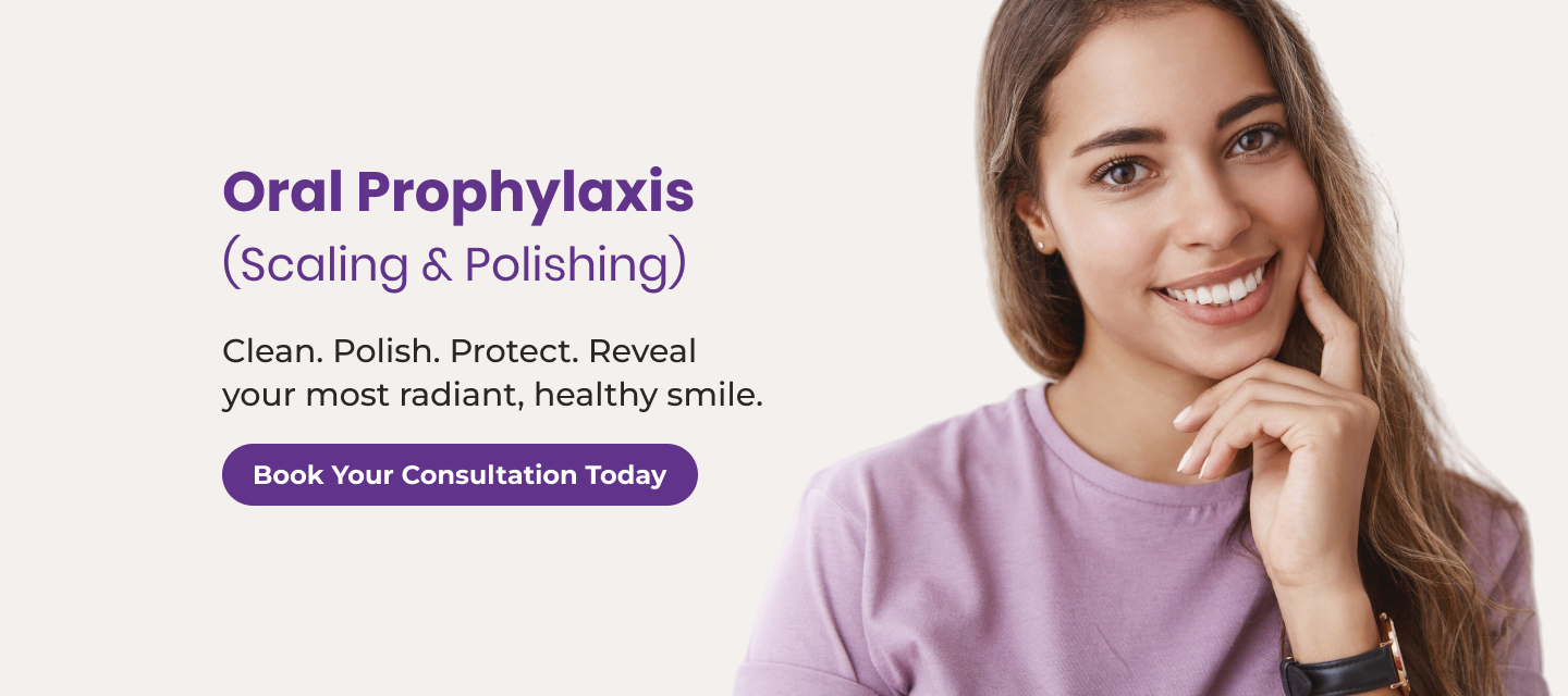 Oral Prophylaxis Scaling - Sasha
