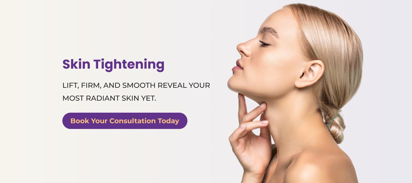 Skin Tightening - Sasha